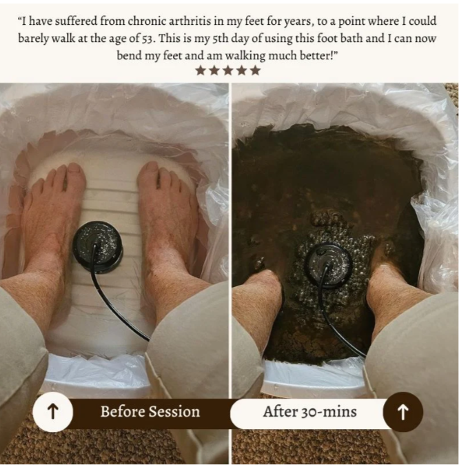 Ionic Foot Spa - At Home Detox – Healifeco
